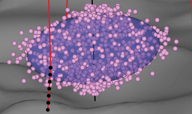 Microseisgram | Microseisgram microseismic software